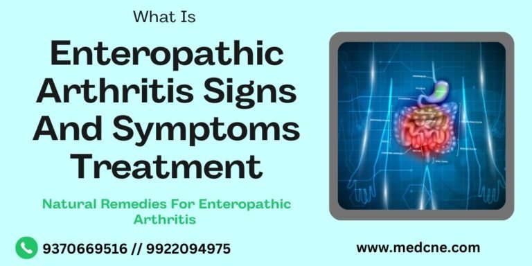 Enteropathic Arthritis Signs And Symptoms Treatment - Naturally